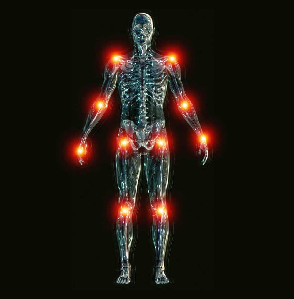 Arthritis 101: Joints Move Pain-Free with Physical Therapy